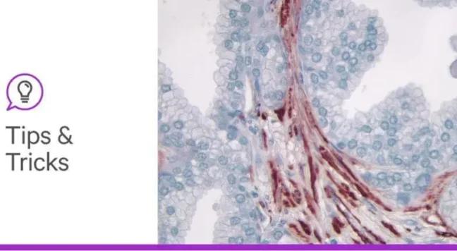 Improving IHC & IF Staining Results | Vector Labs