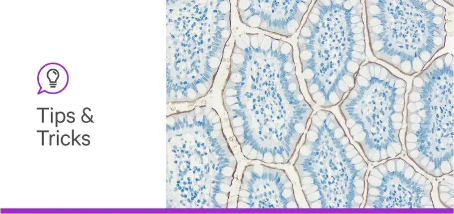 Simplifying Tissue Cross-Reactivity: Screening Humanized Antibodies In ...