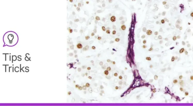 Top Considerations For Selecting Immunohistochemistry (IHC) Detection ...