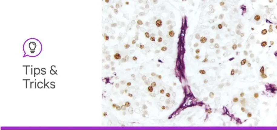 Top Considerations For Selecting Immunohistochemistry Ihc Detection Reagents Vector Labs
