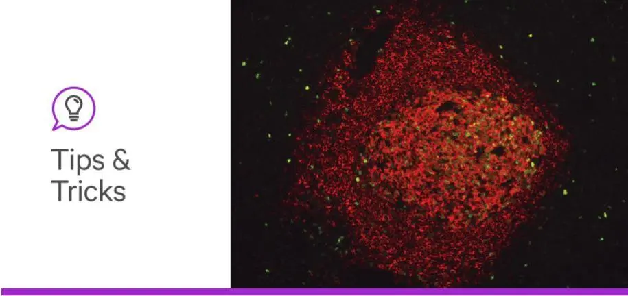 Reduce Tissue Autofluorescence And Dramatically Enhance Signal-to-Noise ...