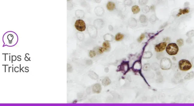 One-step, Two-step, Amplify: How To Choose The Right IHC Detection ...
