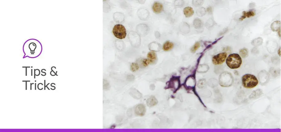 One-step, Two-step, Amplify: How To Choose The Right IHC Detection ...