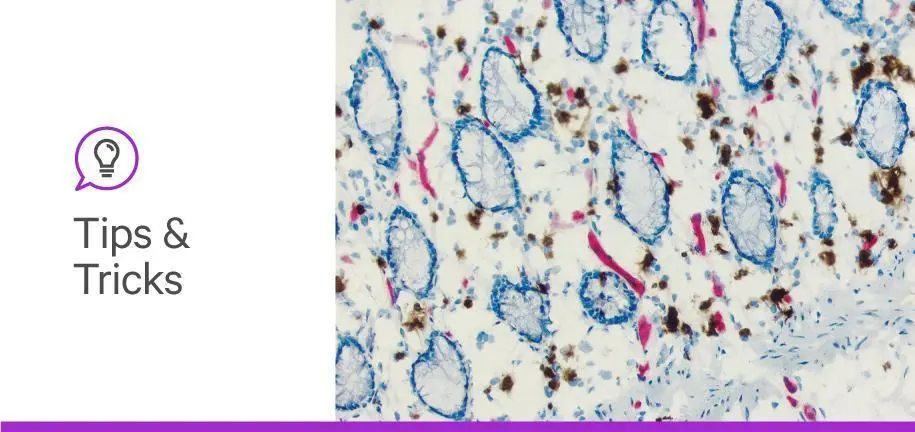 5 Reasons To Use The ImmEdge PAP Pen In Your Immunostaining Workflow | Vector Labs