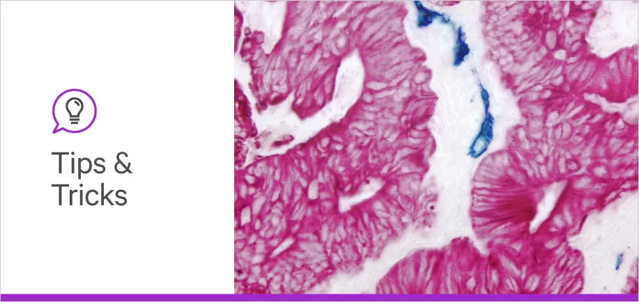 All About VECTASTAIN® ABC Kits For Immunodetection | Vector Labs