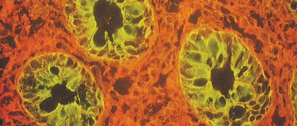 Lectins | Vector Labs