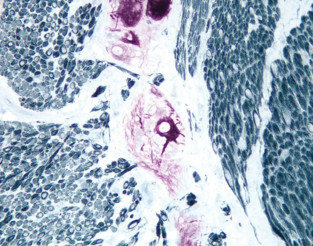 Easy As Do-Re-Mi: Getting Started With Multiplex Immunohistochemistry | Vector Labs
