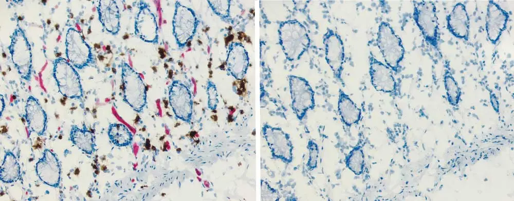 Getting To The Specifics: Blocking For Immunohistochemistry | Vector Labs