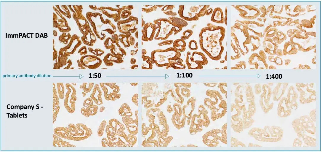 A Simple Guide To Immunohistochemistry Substrate Selection | Vector Labs