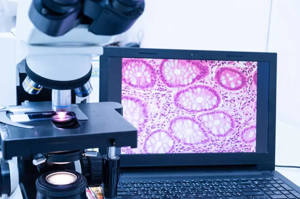 Getting To The Specifics: Blocking For Immunohistochemistry | Vector Labs