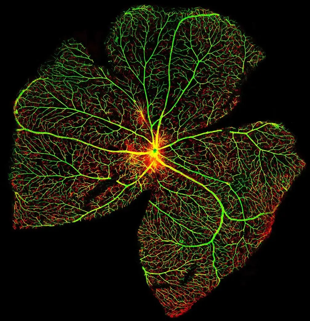 Jennifer Kielczewski, NIH/NEI, US | Vector Labs