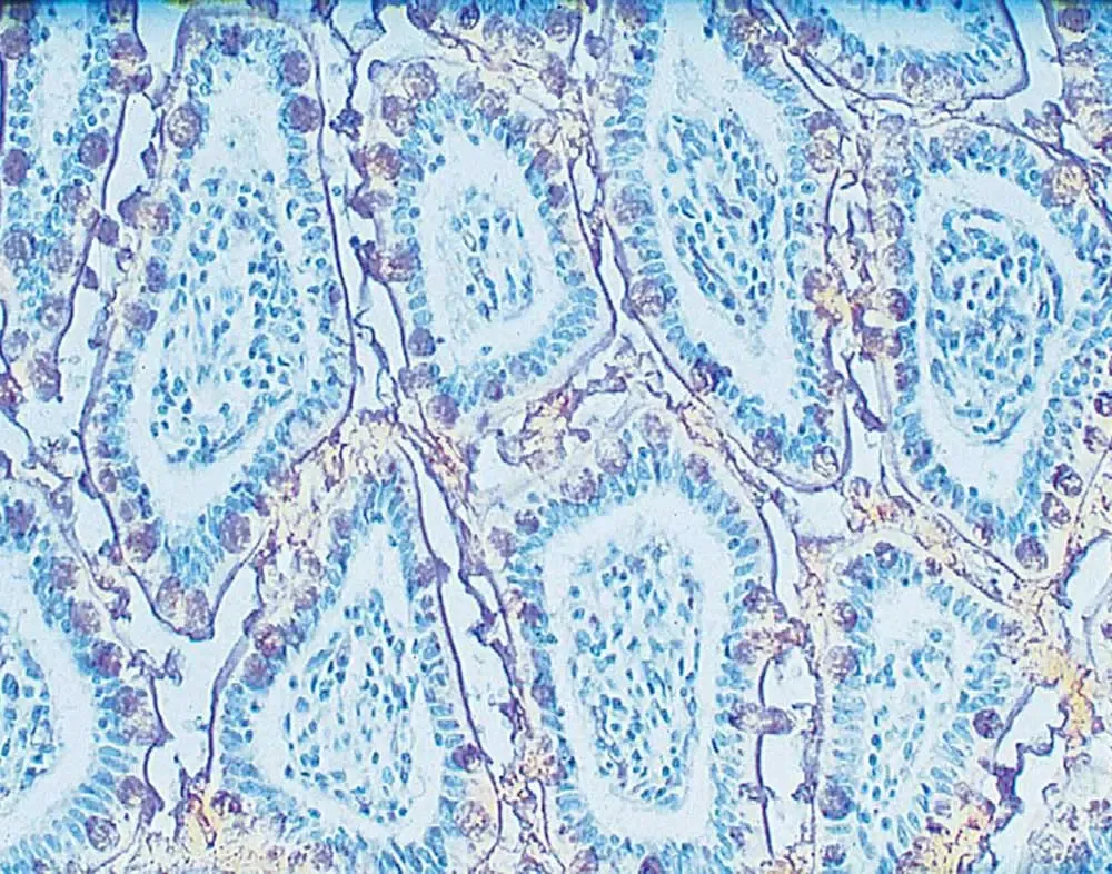 Leveraging Lectins For Glycan Analysis | Vector Labs