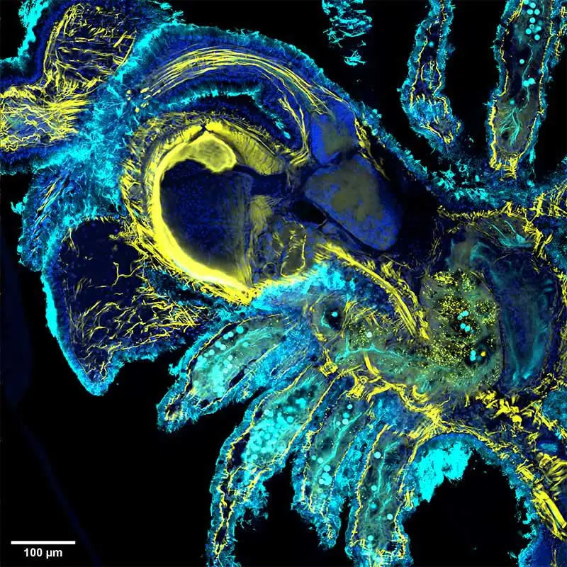 Second Place Winning Image Cheyenne Tait, University Of Massachusetts ...
