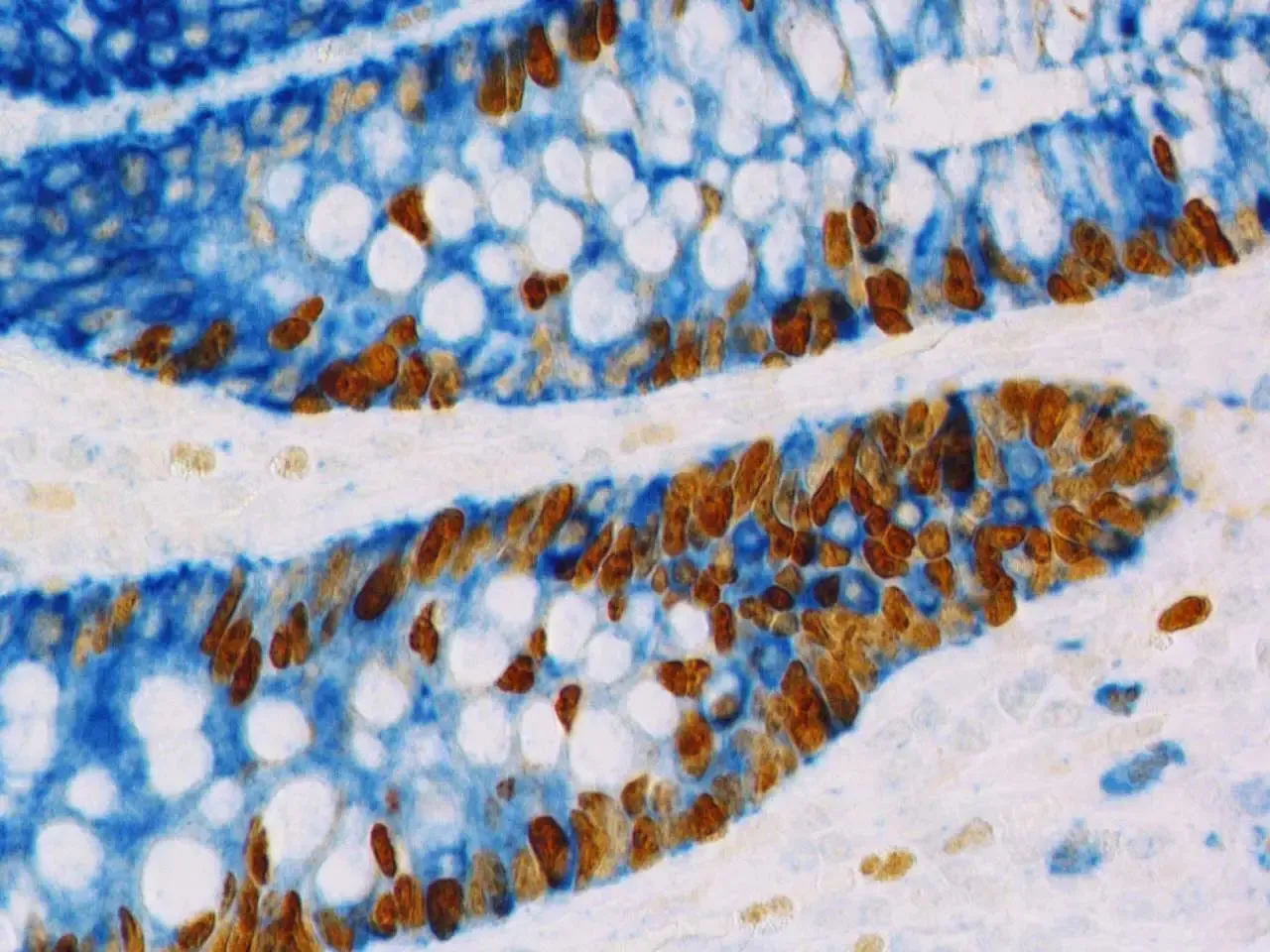 The End Of The Line: Considerations For Mounting Media Selection ...