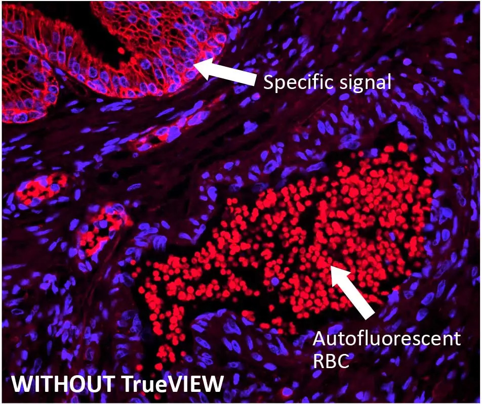 Reduce Tissue Autofluorescence And Dramatically Enhance Signal-to-Noise ...