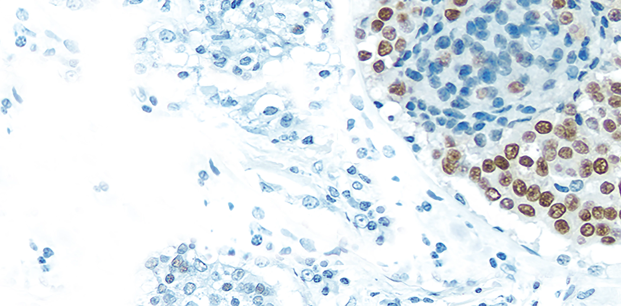 Antigen Unmasking | Vector Labs