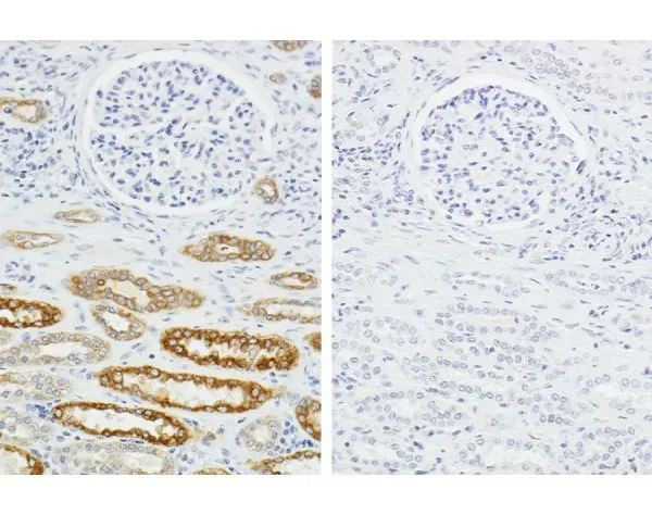 Simplifying Tissue Cross-Reactivity: Screening Humanized Antibodies In ...
