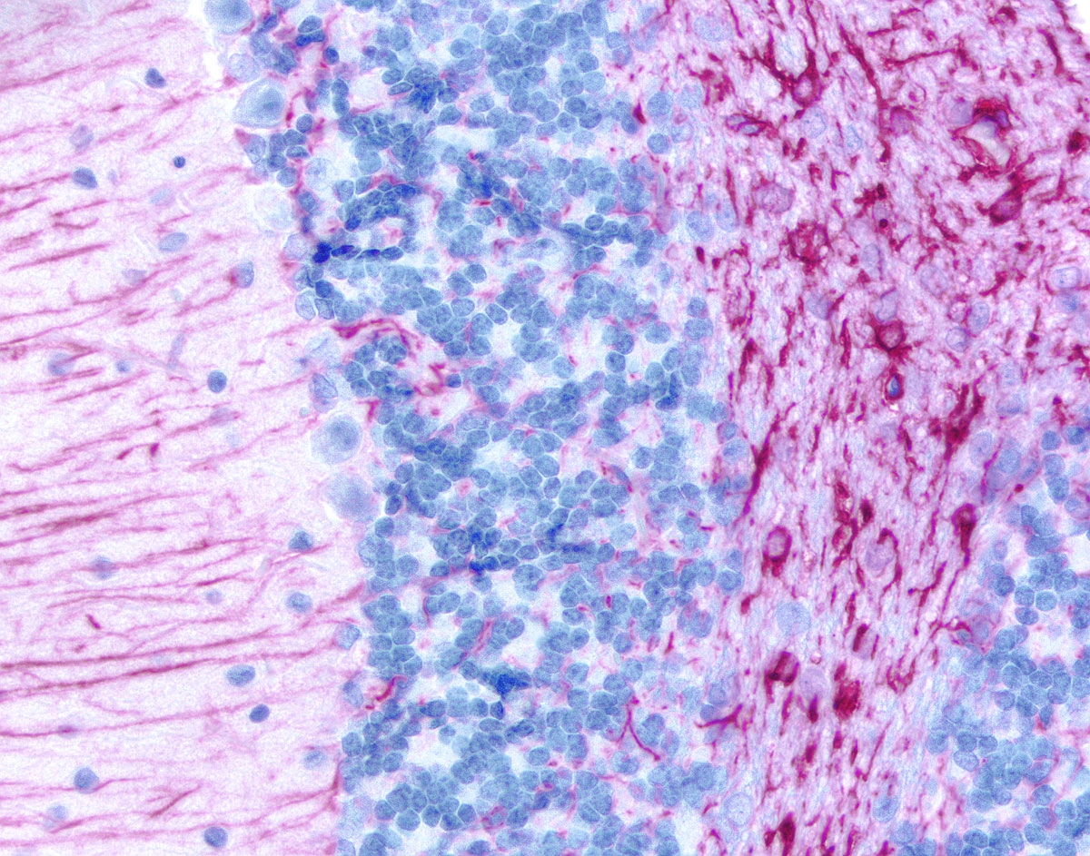 Immunohistochemistry (IHC) | Vector Labs