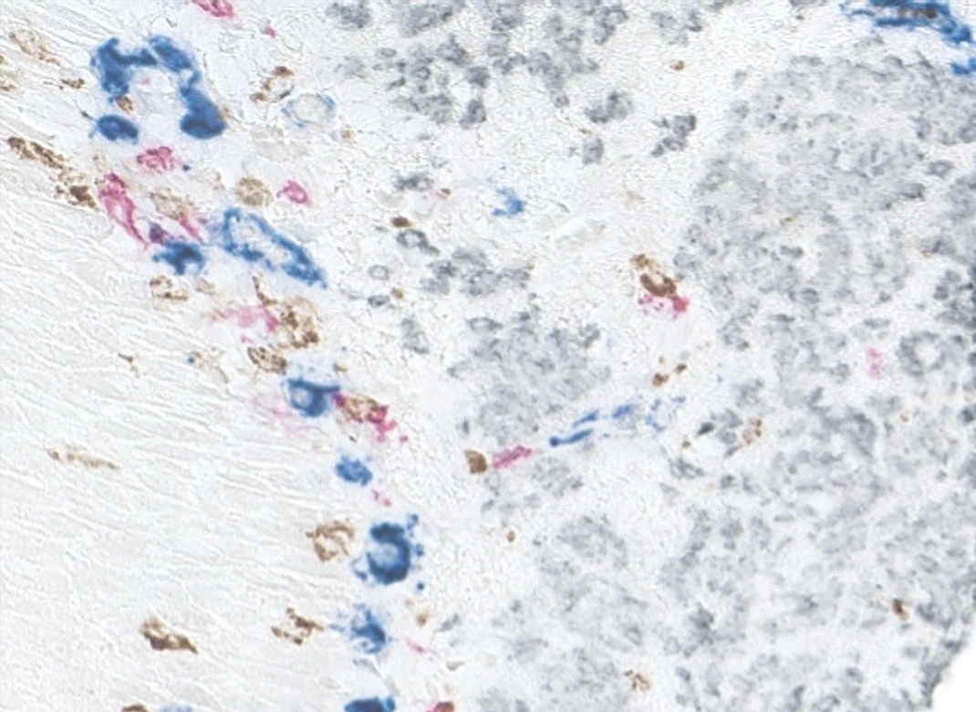 Immunohistochemistry (IHC) | Vector Labs