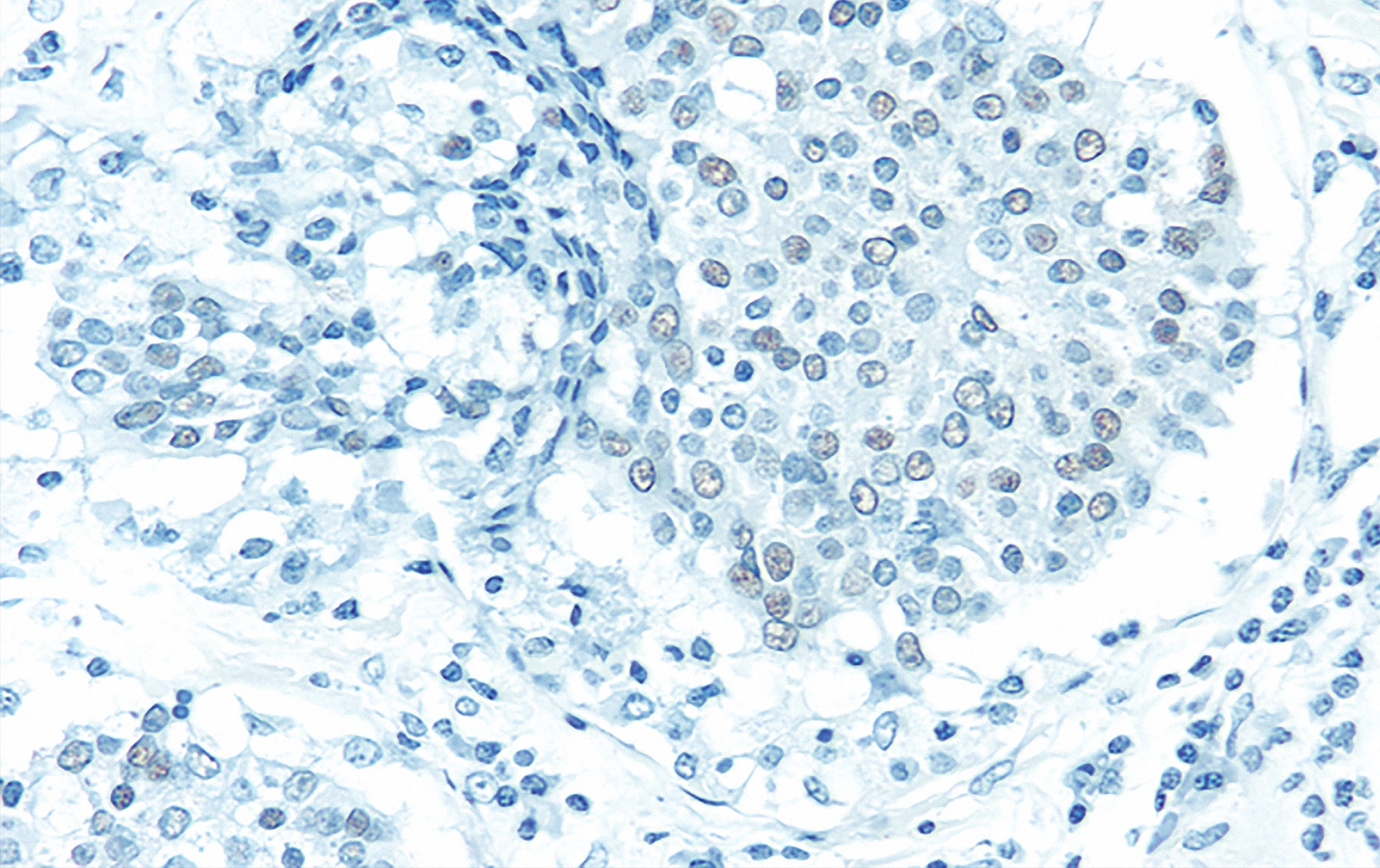 Immunohistochemistry (IHC) | Vector Labs