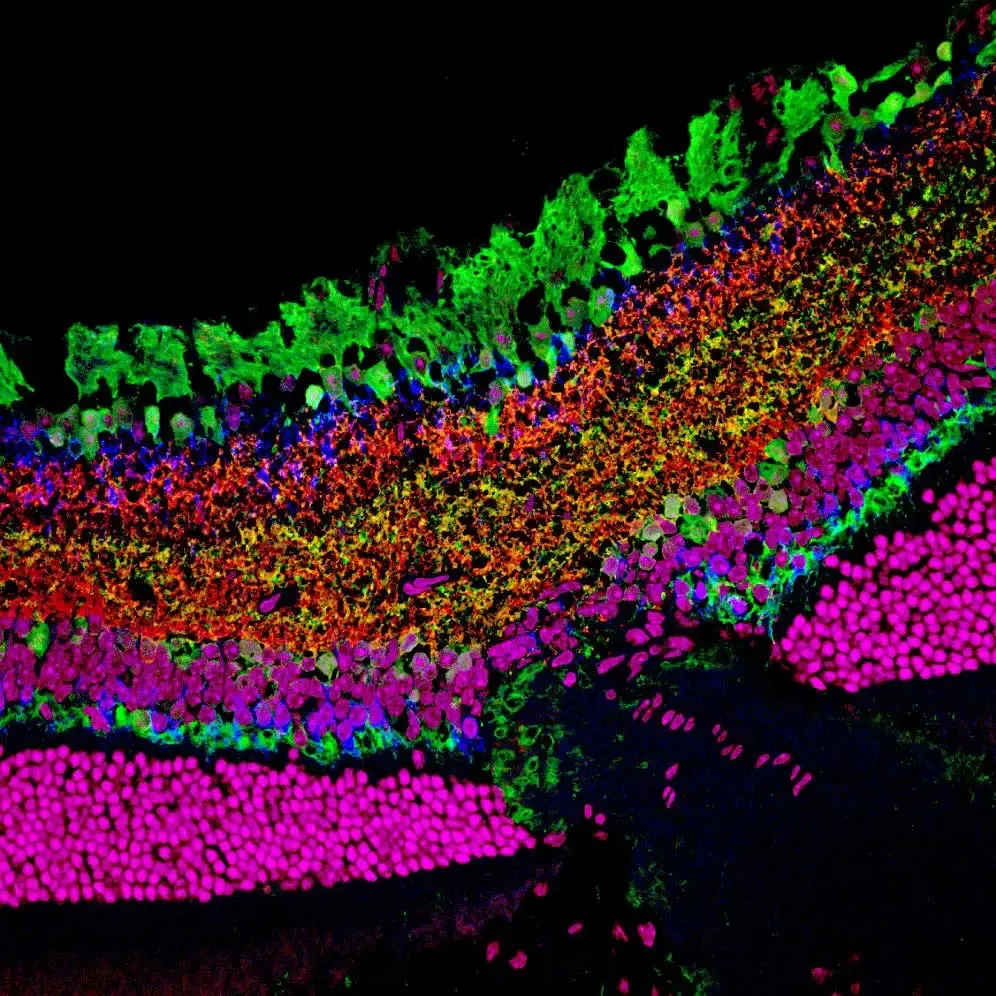 Jennifer Kielczewski, NIH/NEI Biological Imaging Core Facility, USA ...