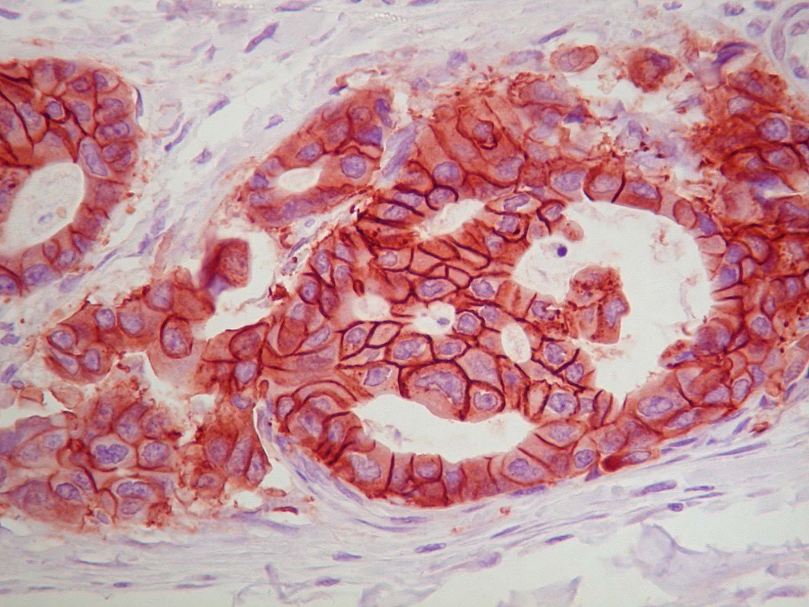 ImmPRESS® Polymer Reagents For IHC | Vector Labs